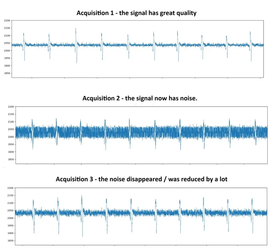 Mysterious Noise On Adc Stmicroelectronics Community 0316