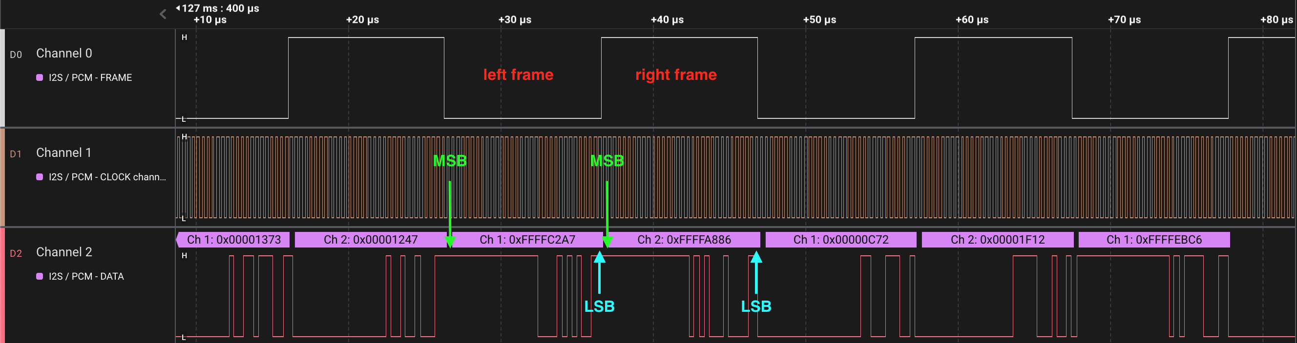 Solved Stm32u5 Sai In I2s Mode Gpdma Stmicroelectronics Community 