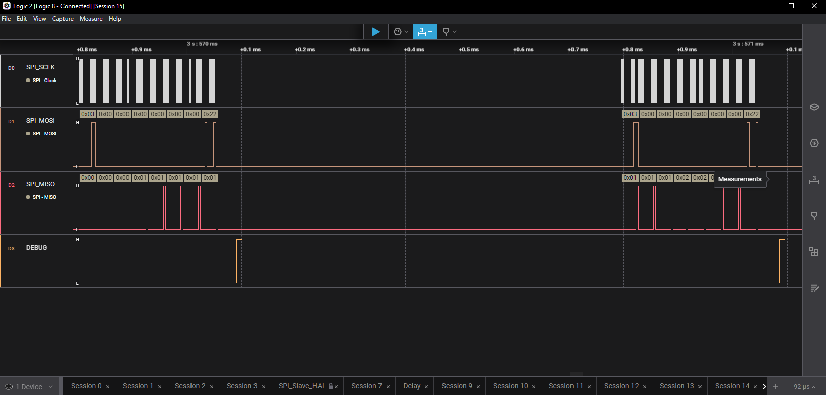 Solved: SPI MISO shifted - STMicroelectronics Community