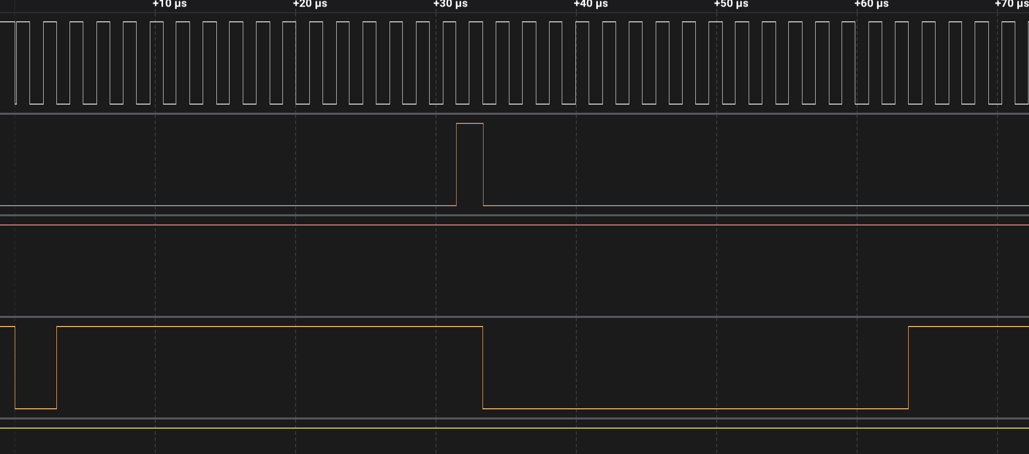 Solved: I2S weird bit shift problem - STMicroelectronics Community